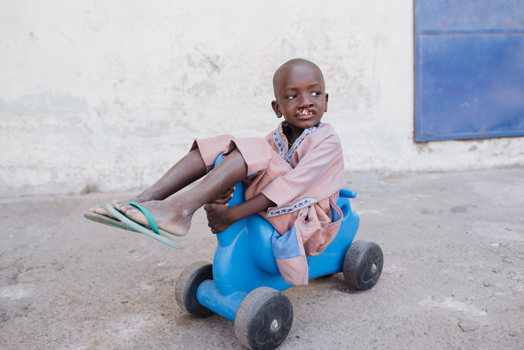 ‘The Gifts Within’: Hamadou Finds Hope - Mercy Ships Africa