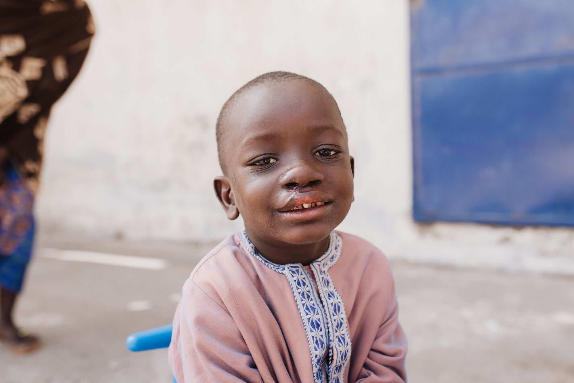 ‘The Gifts Within’: Hamadou Finds Hope - Mercy Ships Africa