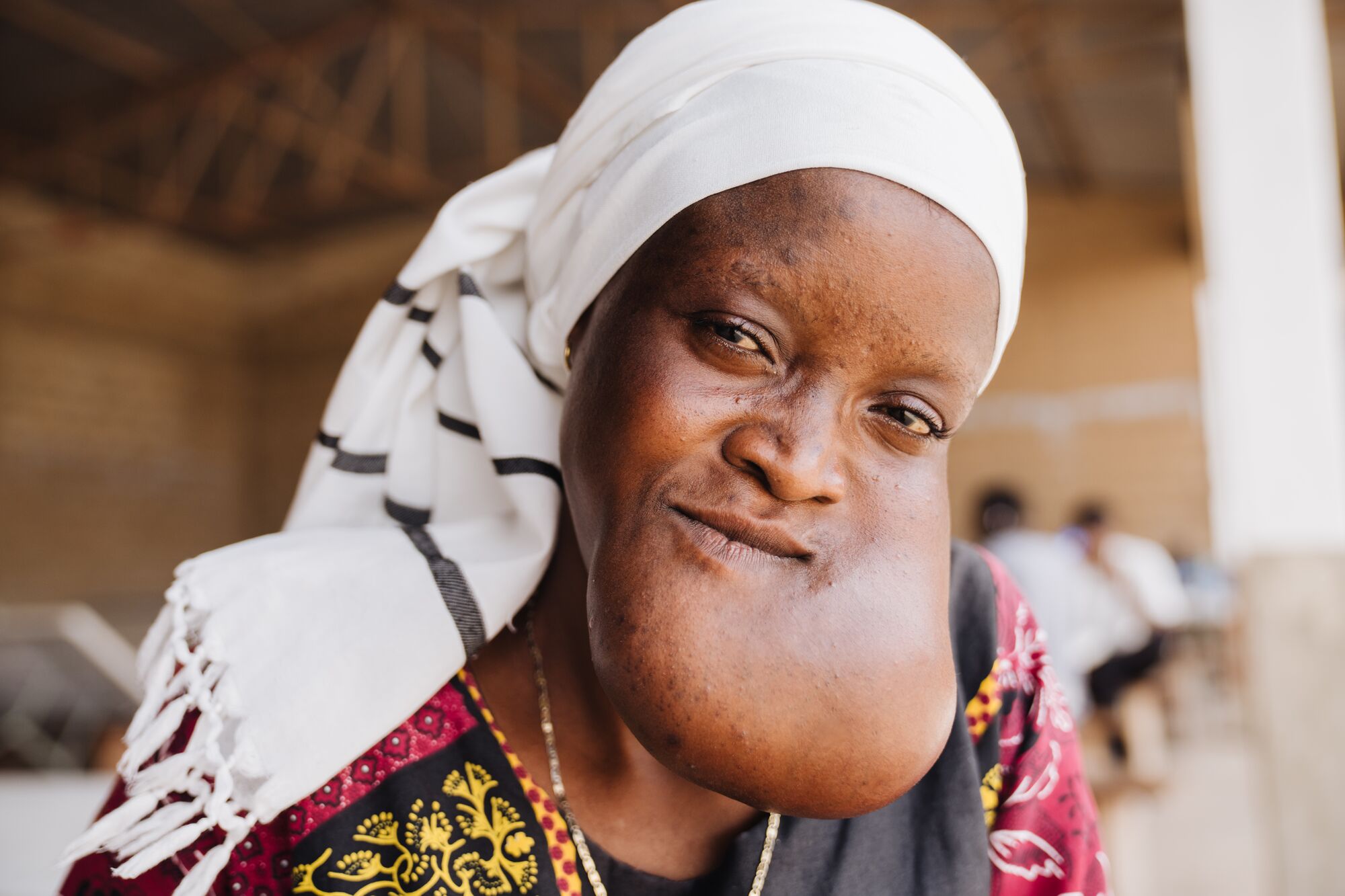 The Future Holds Great Promise: Diarra's Story - Mercy Ships Africa