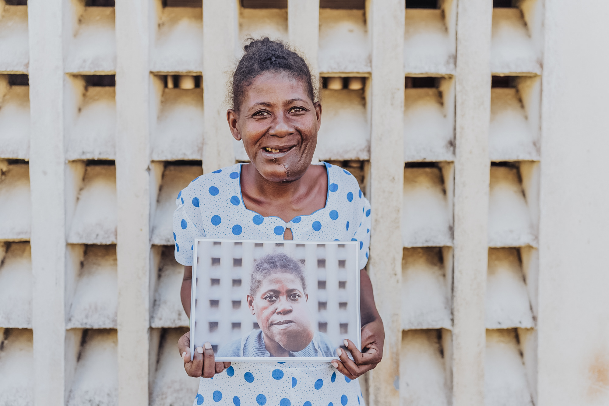 After a Decade of Suffering Under a Growing Tumor, Hope and Healing ...